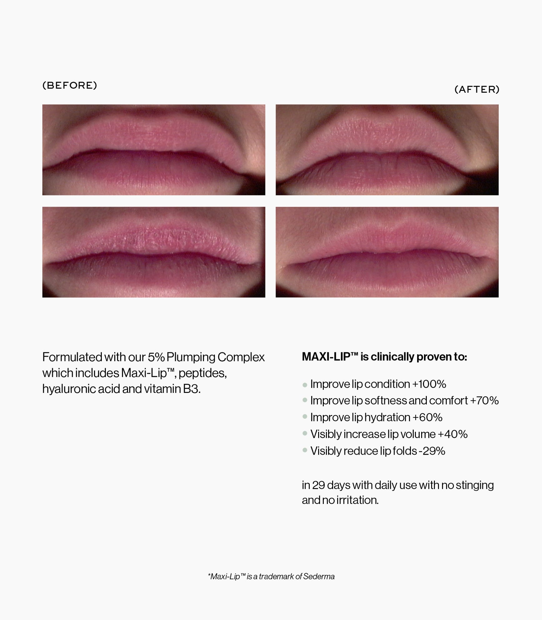 Inner Tube Lip Plumping Treatment - MAKE Beauty